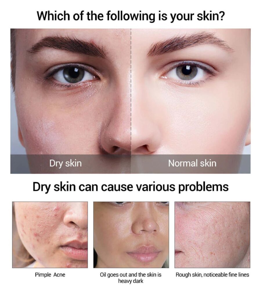 LAJU HYALURONIC ACID serum 30ML - LAJU